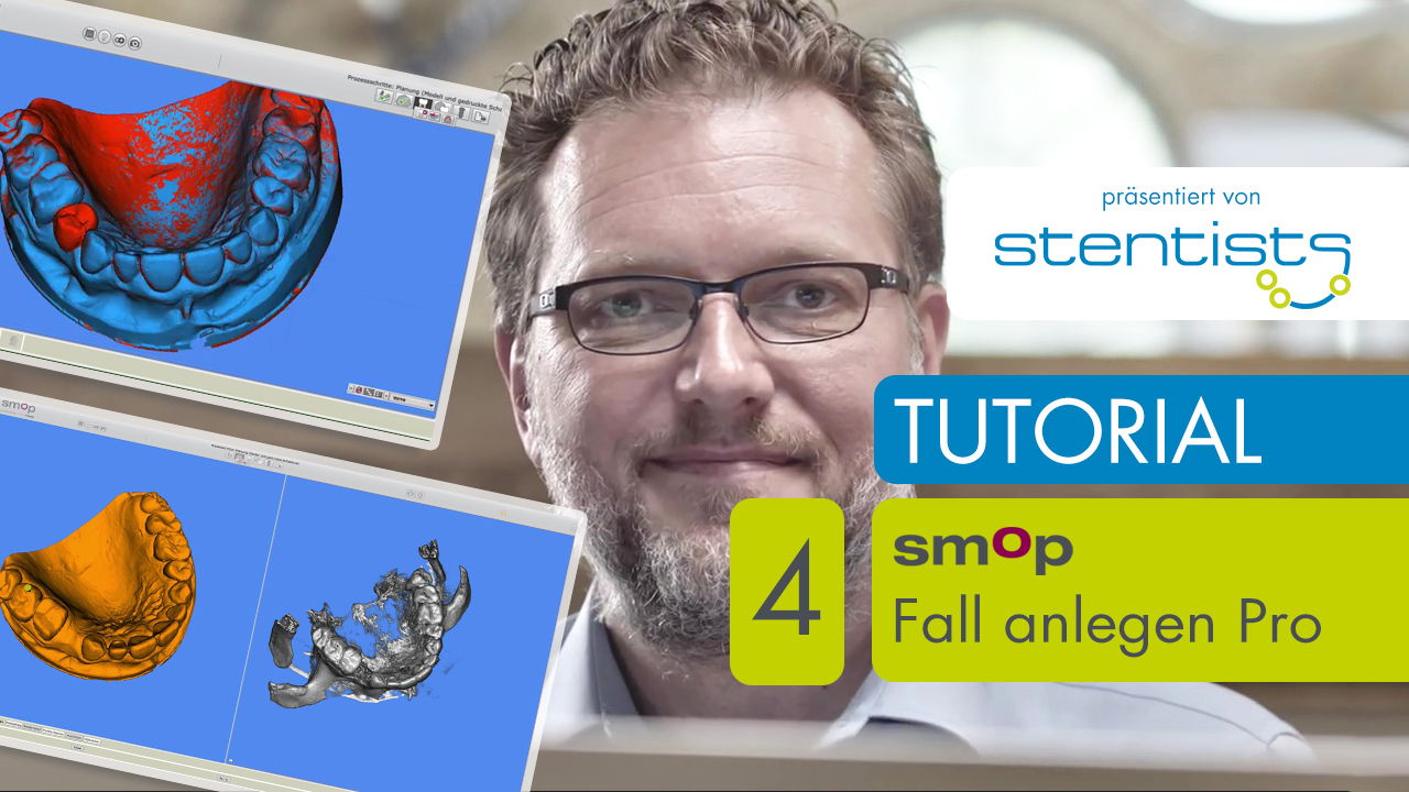 smop Tutorials - stentists - digitale Planungsdienstleistungen Jens ...